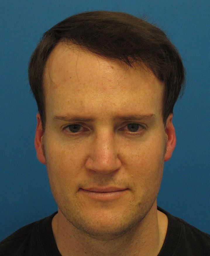 Dr. Hasson 4634 U.F. Bellicapelli Forum